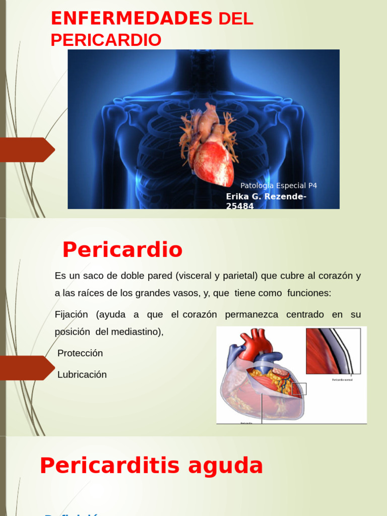 Enfermedades Del Pericardio | PDF | Especialidades Medicas ...