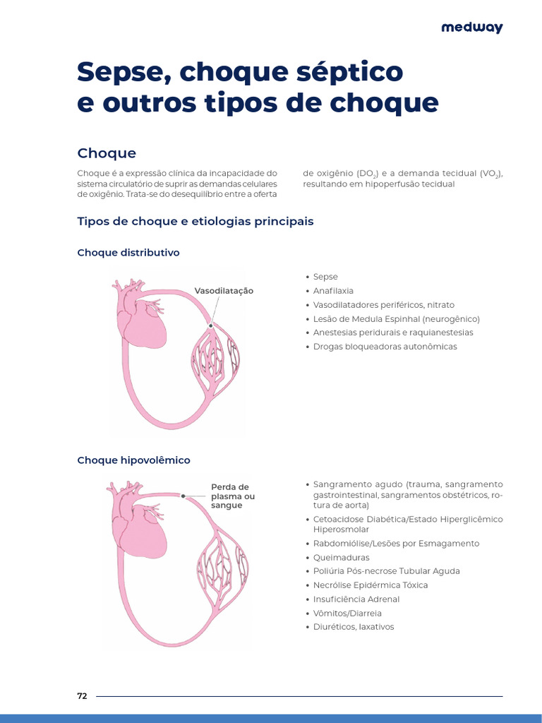 Tipos e Tratamentos de Choque Clínico | PDF | Sepse | Choque (circulatório)