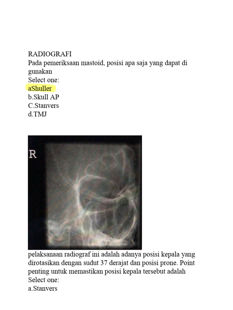 Soal Uas Radiografi Kating | PDF