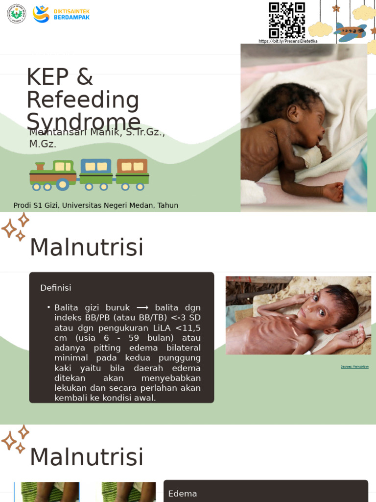 KEP Dan Refeeding Syndrome | PDF