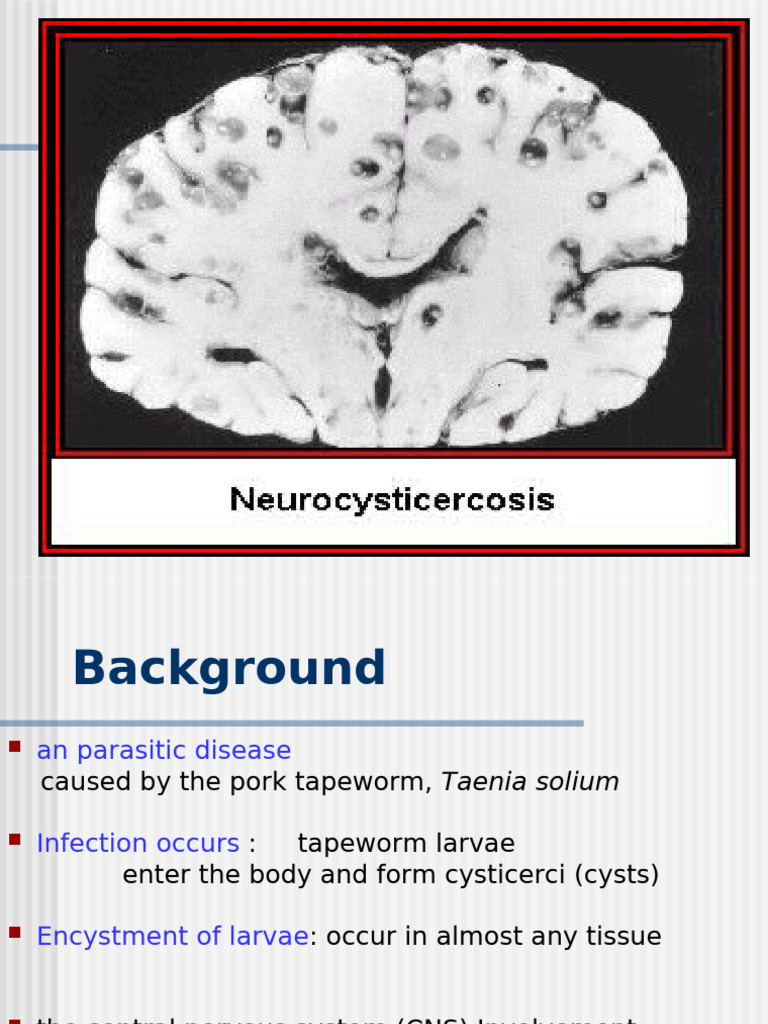 Stages of Neurocysticercosis Explained | PDF | Cerebrospinal Fluid ...