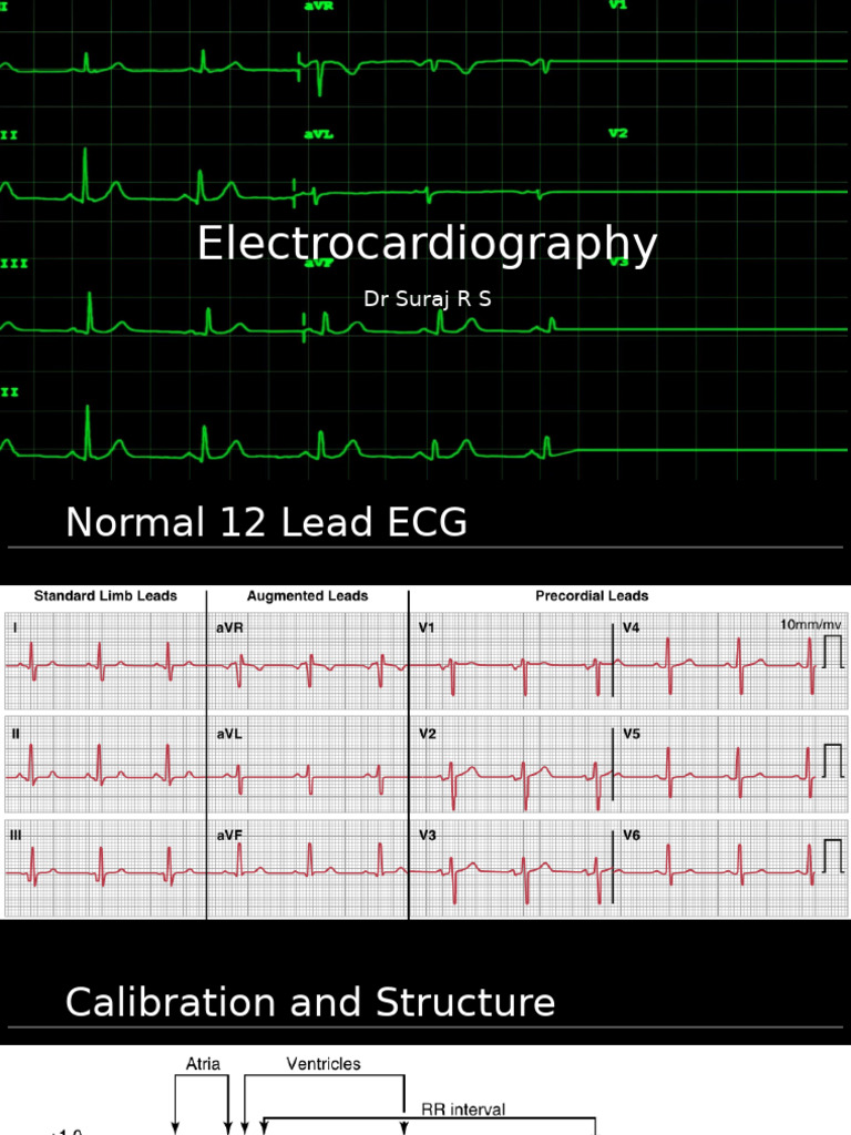 Comprehensive ECG Interpretation Guide | PDF | Electrocardiography ...