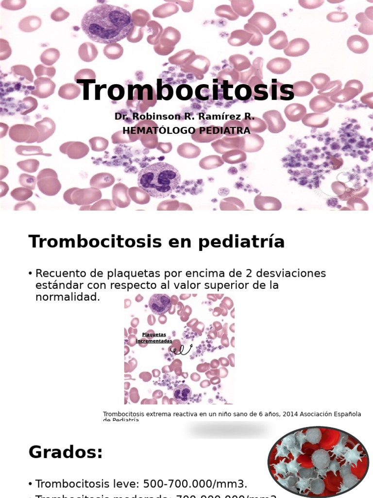 Trombocitosis en Pediatría: Grados y Tratamiento | PDF | Trombo ...