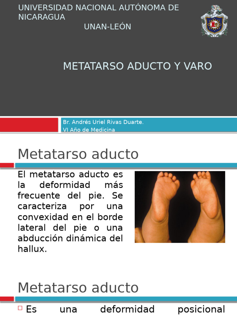 Metatarso Aducto y Varo | PDF