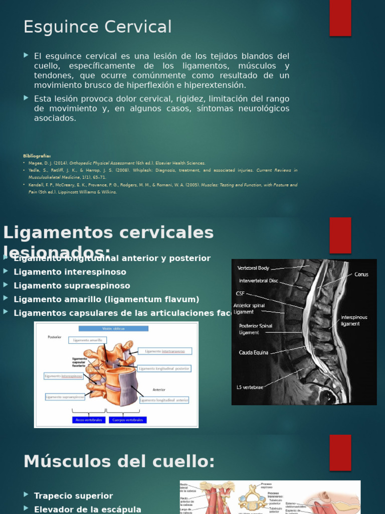 Esguince Cervical Pdf Articulación Sistema Esquelético