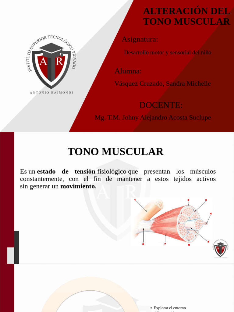 Alteracion Del Tono Muscular | PDF | Distonia | Flexibilidad (anatomía)