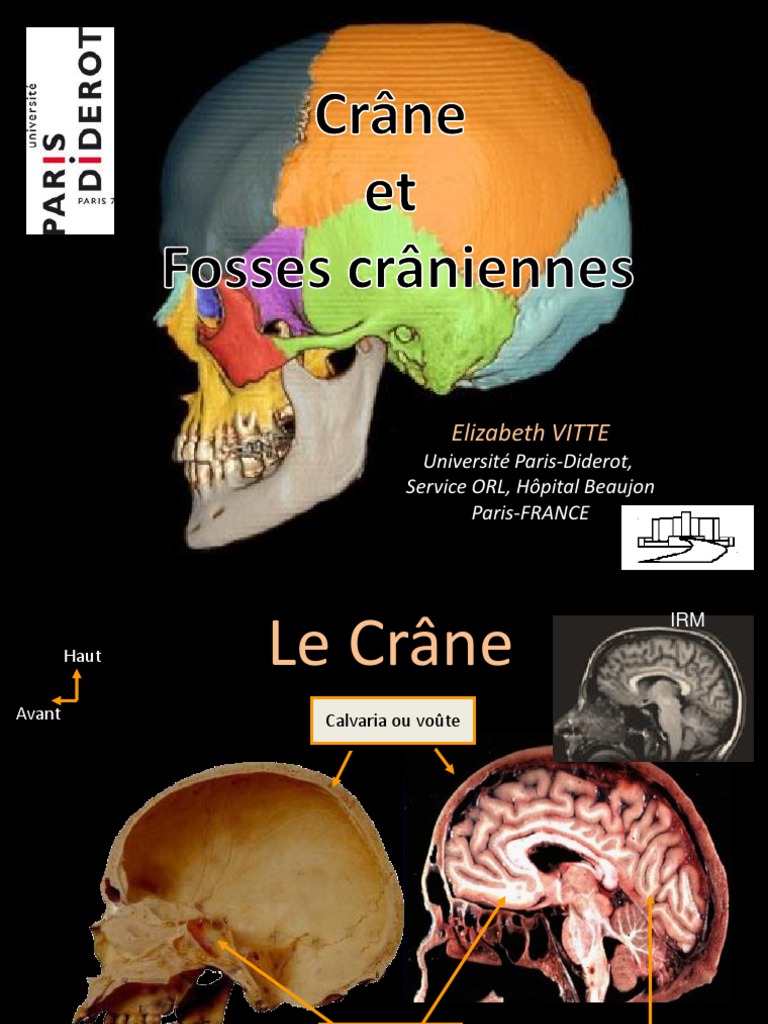 Cranes Et Fosses Craniennes | PDF | Système squelettique | Tête et cou chez l'humain