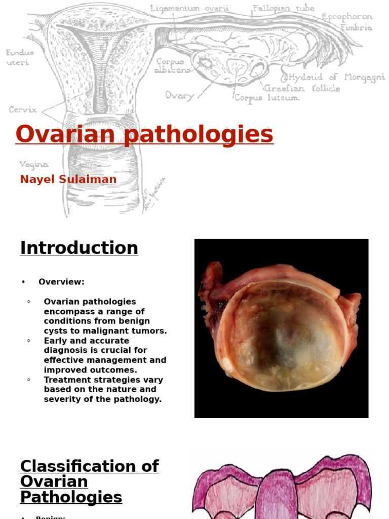 Ovarian Pathologies: Diagnosis & Treatment | PDF | Ovarian Cancer ...