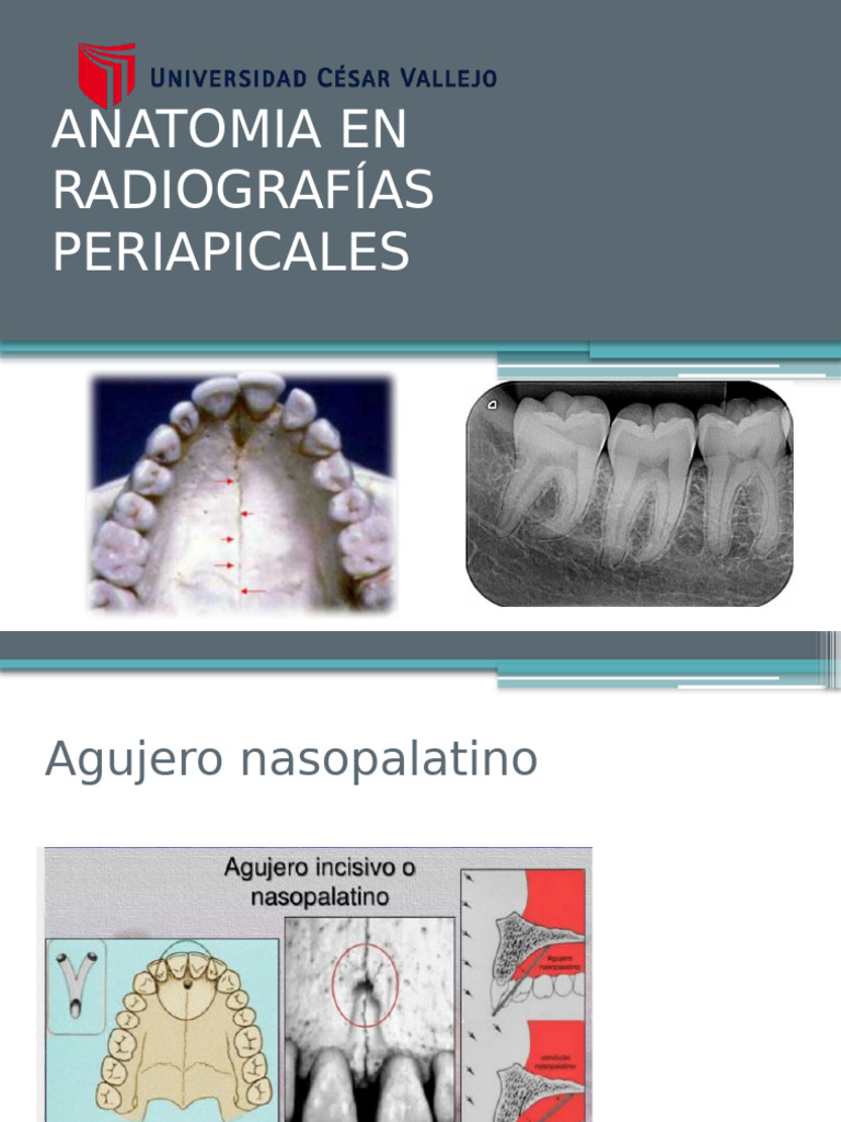 Anatomia en Radiografías Periapicales | PDF