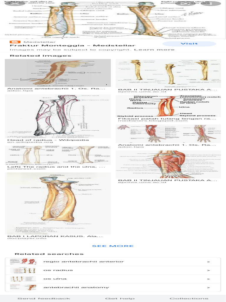 Searchq Antebrachii+x+Ray&Rlz 1CDGOYI EnID937ID937&Hl en GB&PRMD Isnxv ...