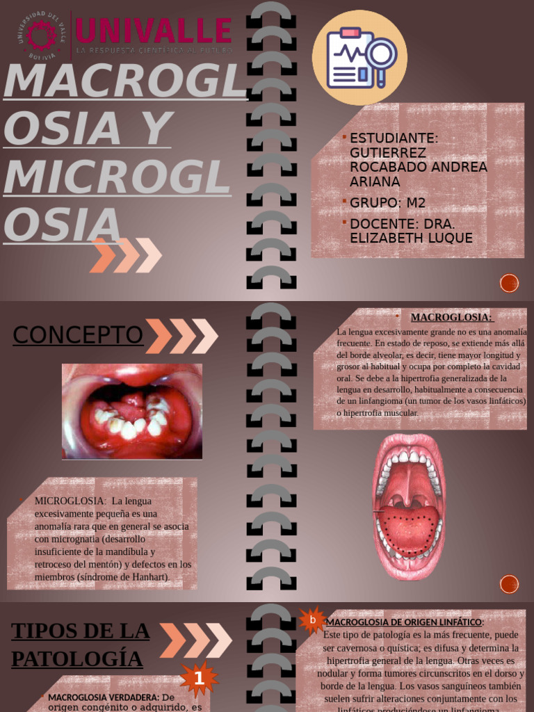 Microglosia y Macroglosia: Diagnóstico y Tratamiento | PDF | Medicina ...