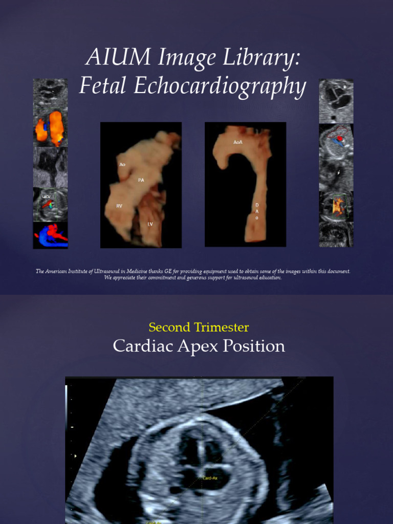 Fetal Echocardiography | PDF | Heart Valve | Ventricle (Heart)