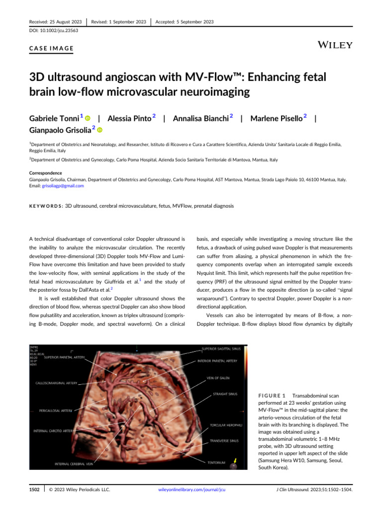 3D Ultrasound Angioscan With MVFlow Enhancing Fetal Brain Lowflow | PDF ...