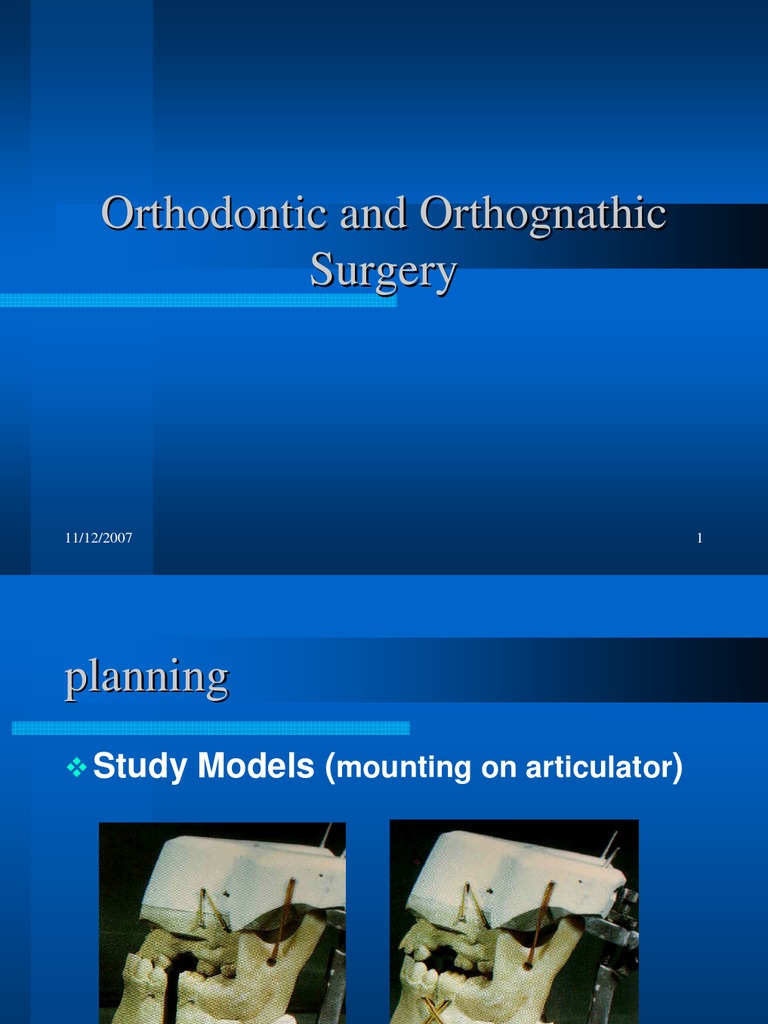 Orthognathic Surgery | PDF