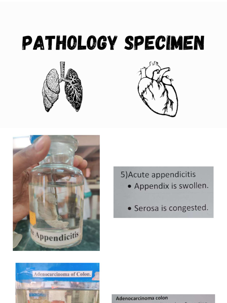 Pathology Specimen Pdf