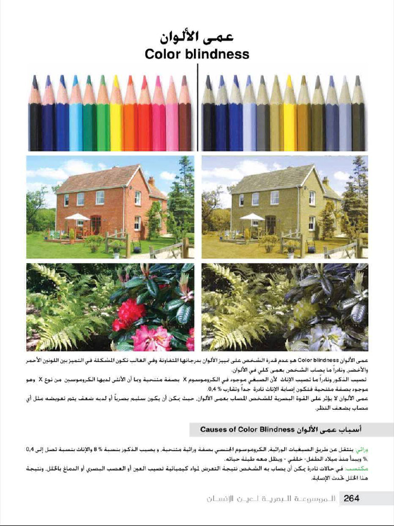 عمى الالوان @Younis - Ophthalmologist⁩ | PDF