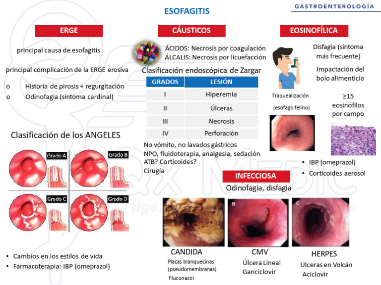 Tipos y Tratamientos de Esofagitis | PDF | La enfermedad por reflujo ...