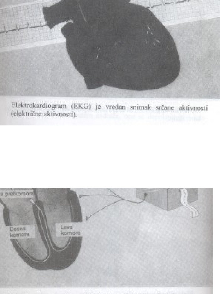 Dubin Ekg | PDF