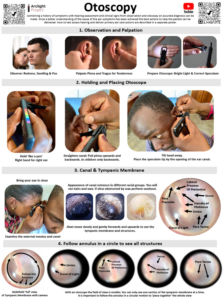 Otoscopy Techniques for Ear Examination | PDF
