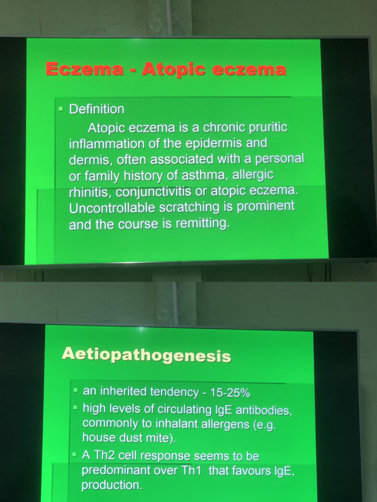 Atopic Eczema | PDF