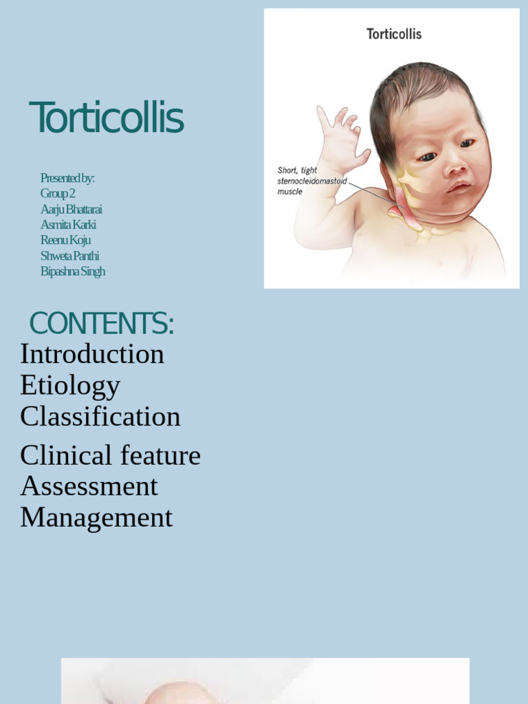 Torticollis 1 | PDF | Physical Therapy | Medical Specialties