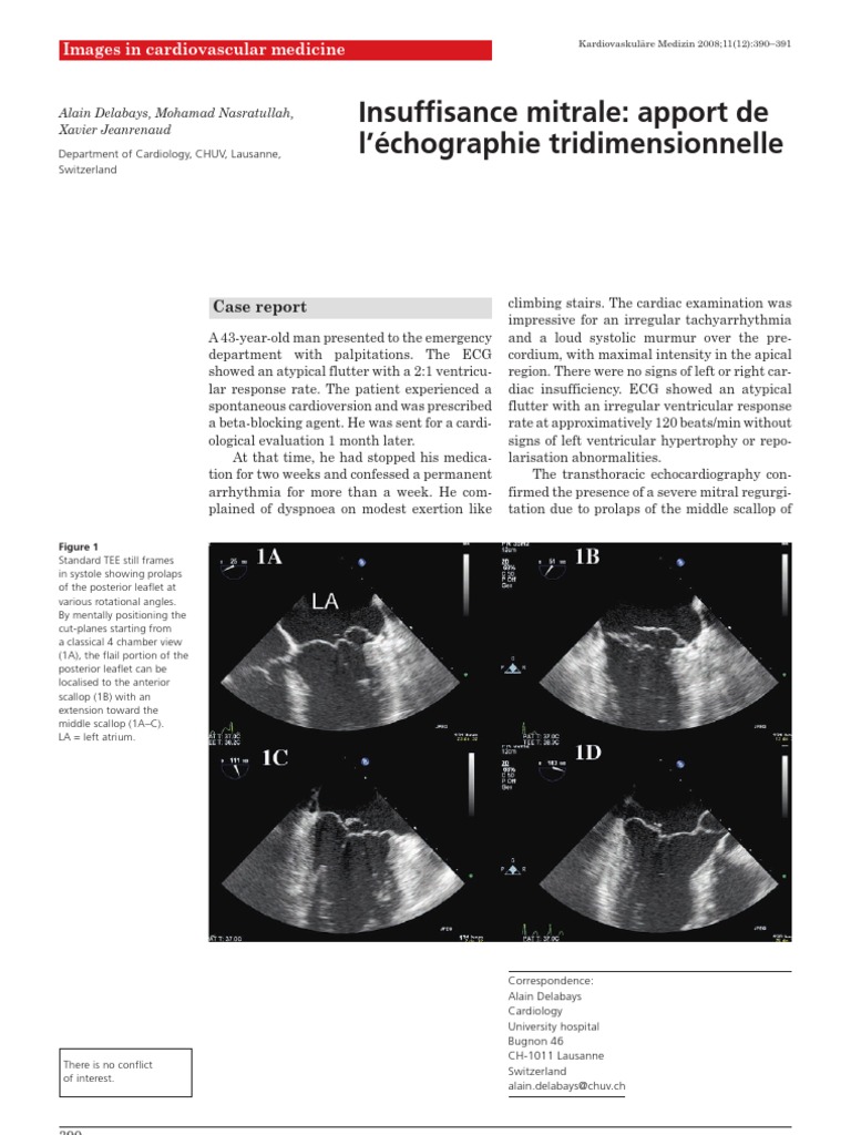 Insuffisance Mitrale Apport de | PDF | Heart Valve | Cardiology