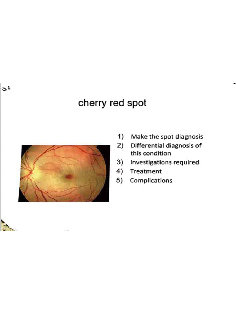 Ophthal Osce 1 With Answers | PDF | Cornea | Medical Specialties