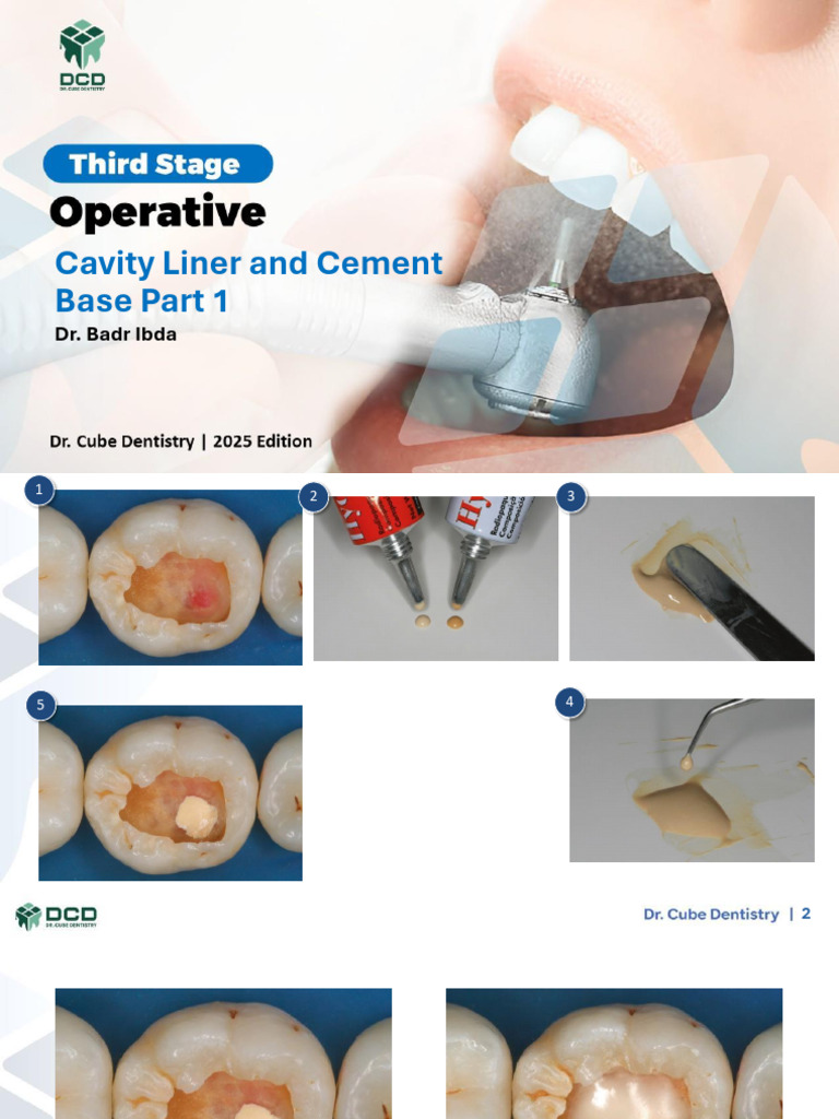Operative3 Lec.8 Cavity Liner and Cement Base P.1 | PDF | Cement ...