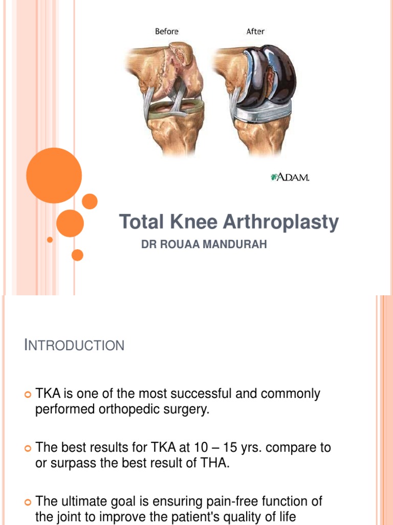 Total Knee Arthroplasty Overview | PDF | Knee | Limbs (Anatomy)