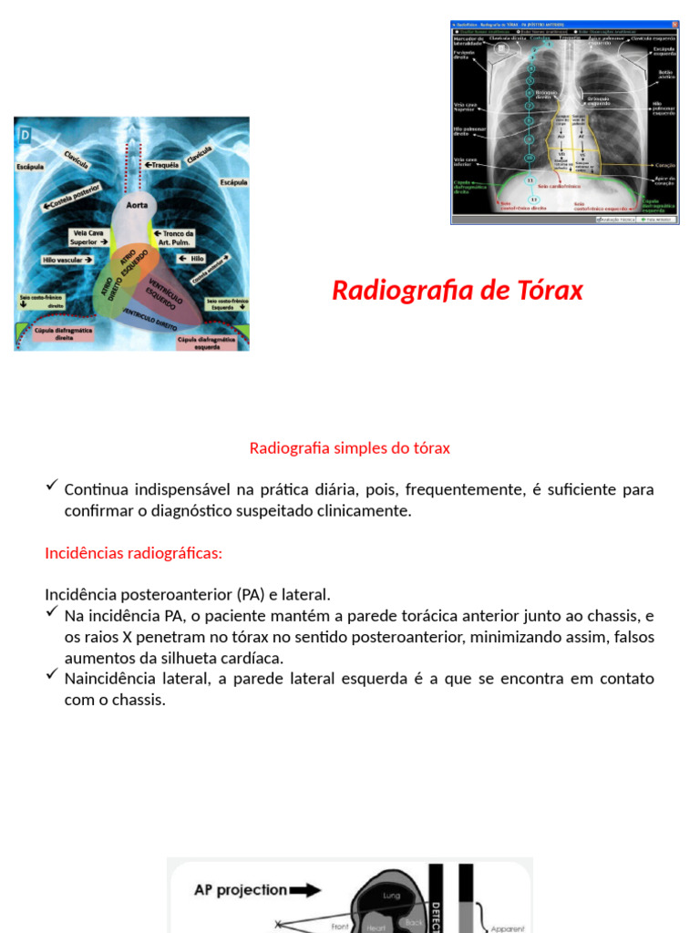 Radiografia de Tórax: Tipos e Indicações | PDF | Radiografia | Raio X