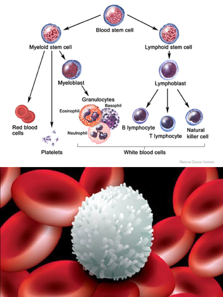 Diseases of WBC | PDF | White Blood Cell | Leukemia