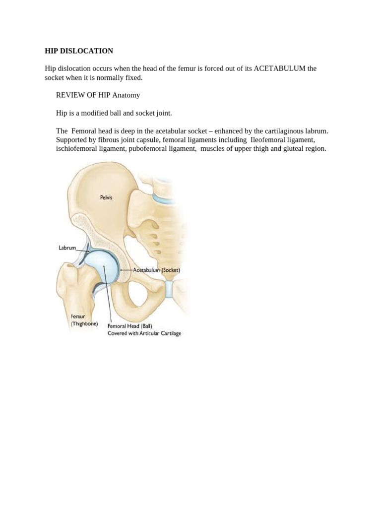 Understanding Hip Dislocation Causes and Treatment | PDF | Hip ...