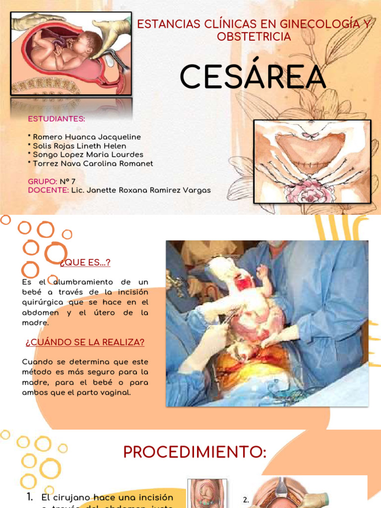 G7 Cesarea Pdf Parto Seccion De Cesárea