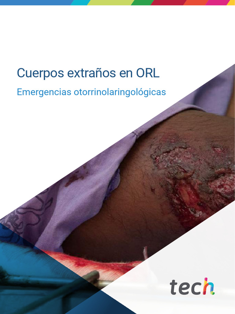 TEMA 2. Cuerpos extraños en ORL | PDF | Nariz humana | Otorrinolaringología