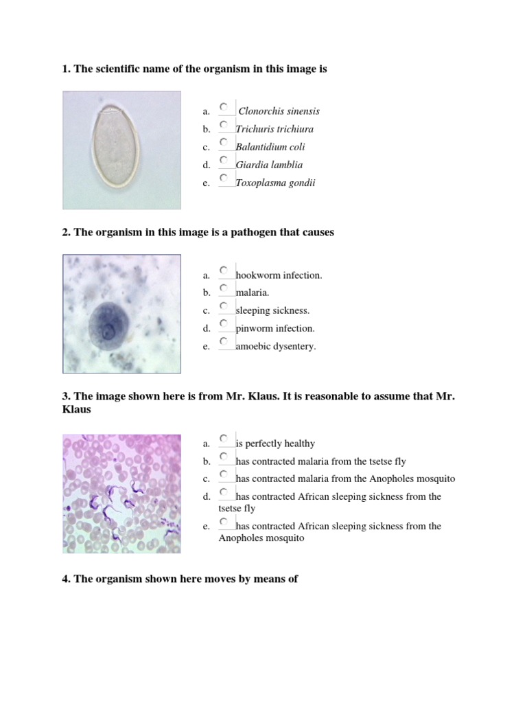 Multiple Choice Parasitology Exam Questions | PDF