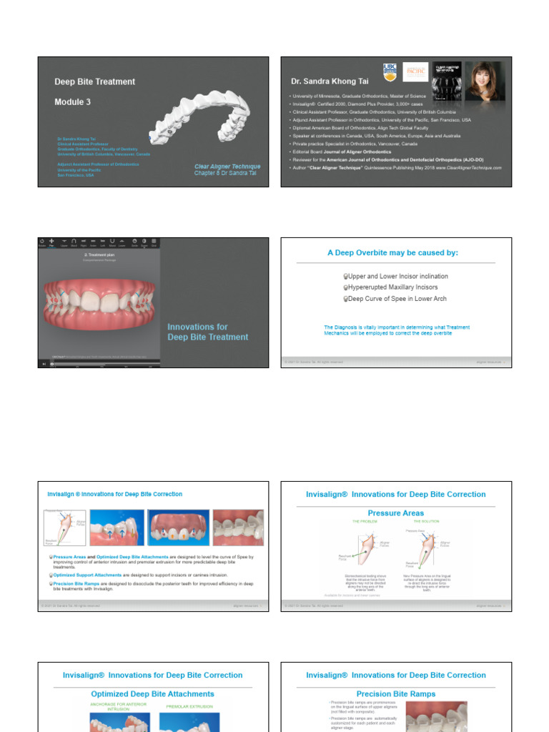 Deep Bite Treatment Innovations Guide | PDF | Orthodontics | Dental Anatomy
