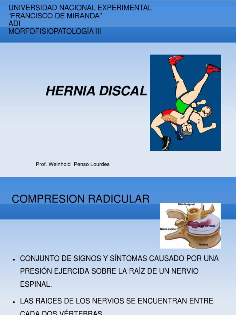 Hernia Discal Presentacion | PDF | Ocio