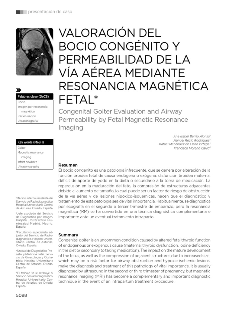 07 Bocio Esp | PDF | Hipertiroidismo | Tiroides