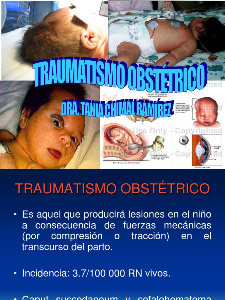 Traumatismo Obstétrico en Recién Nacidos | PDF | Parto | Lesión