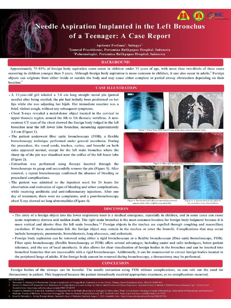 Needle Aspiration Implanted in The Left Bronchus of A Teenager A Case ...