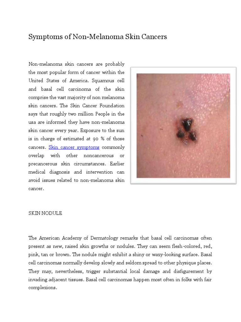 Non-Melanoma Skin Cancer Symptoms Guide | PDF | Social Science | Wellness