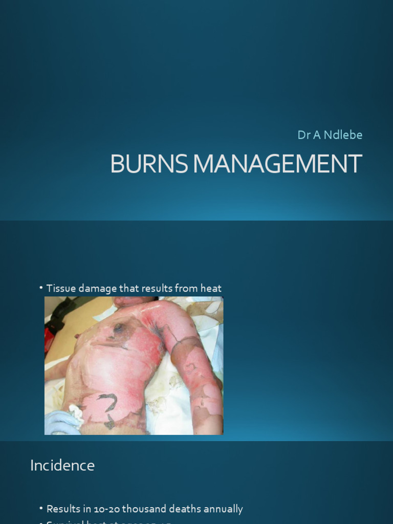 Comprehensive Burns Management Guide | PDF | Burn | Medical Specialties