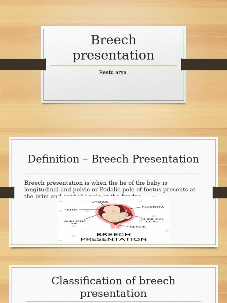 Breech Presentation: Reetu Arya | PDF