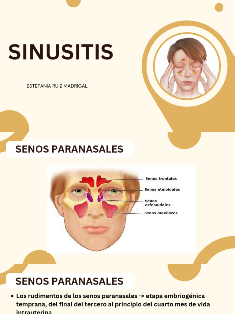 Sinusitis | PDF