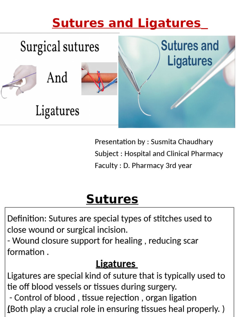 Sutures and Ligatures in Surgery | PDF | Surgical Suture | Wound