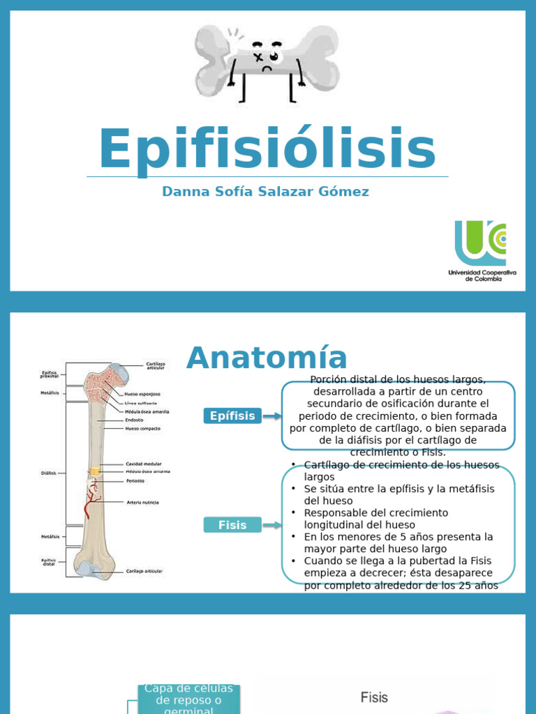 Epifisiolisis: Definición y Tratamiento | PDF | Sistema ...