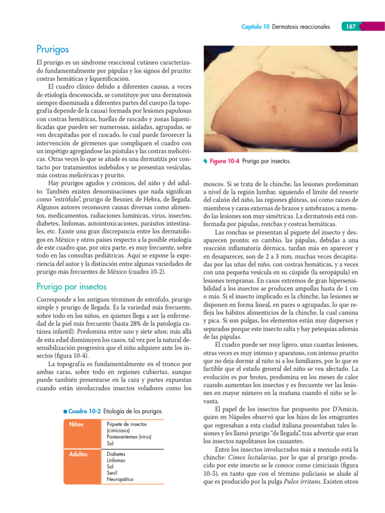 Prurigo Por Insectos | PDF | Especialidades Medicas | Enfermedades y trastornos