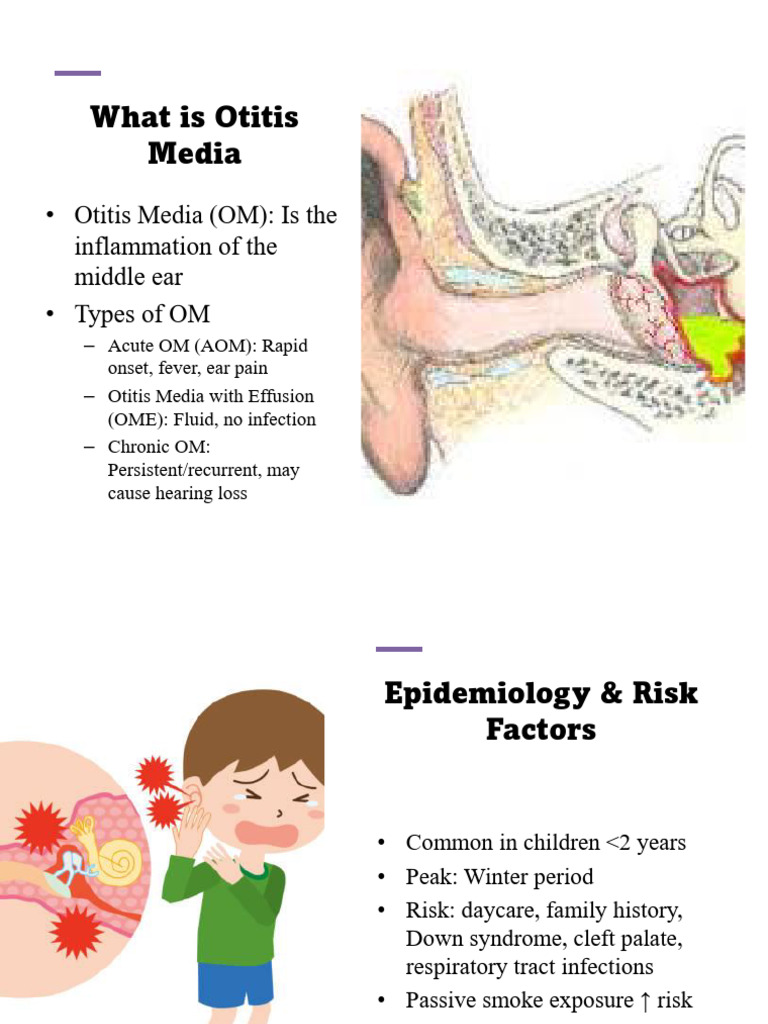Understanding Otitis Media in Children | PDF | Medical Specialties ...