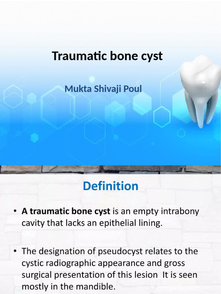 Traumatic Bone Cyst | PDF