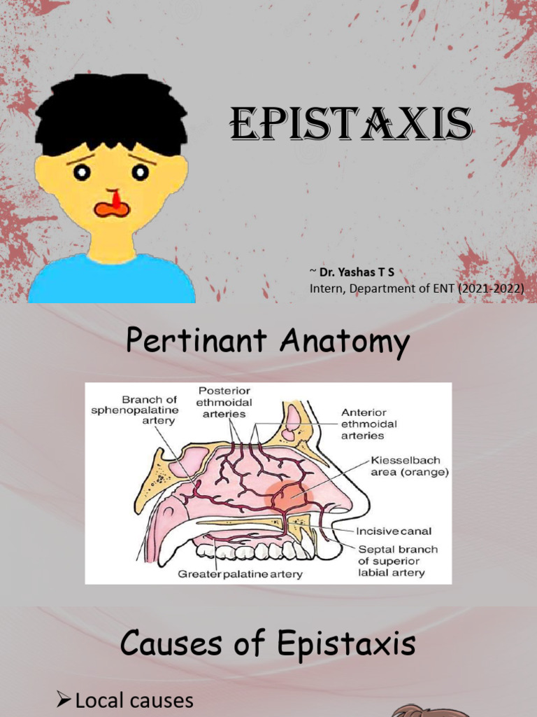 Epistaxis-converted (1) (1) | PDF | Medical Specialties | Clinical Medicine